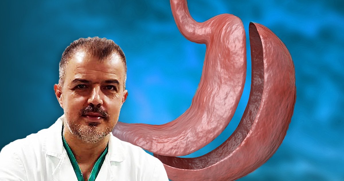 Smanjivanjem želuca mesečno se gubi 3 do 6 kilograma, a dr Dejan ...