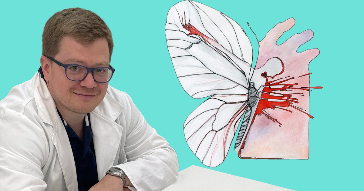 Bulozna epidermoliza je nasledna urođena bolest sa velikim bolovima i ...