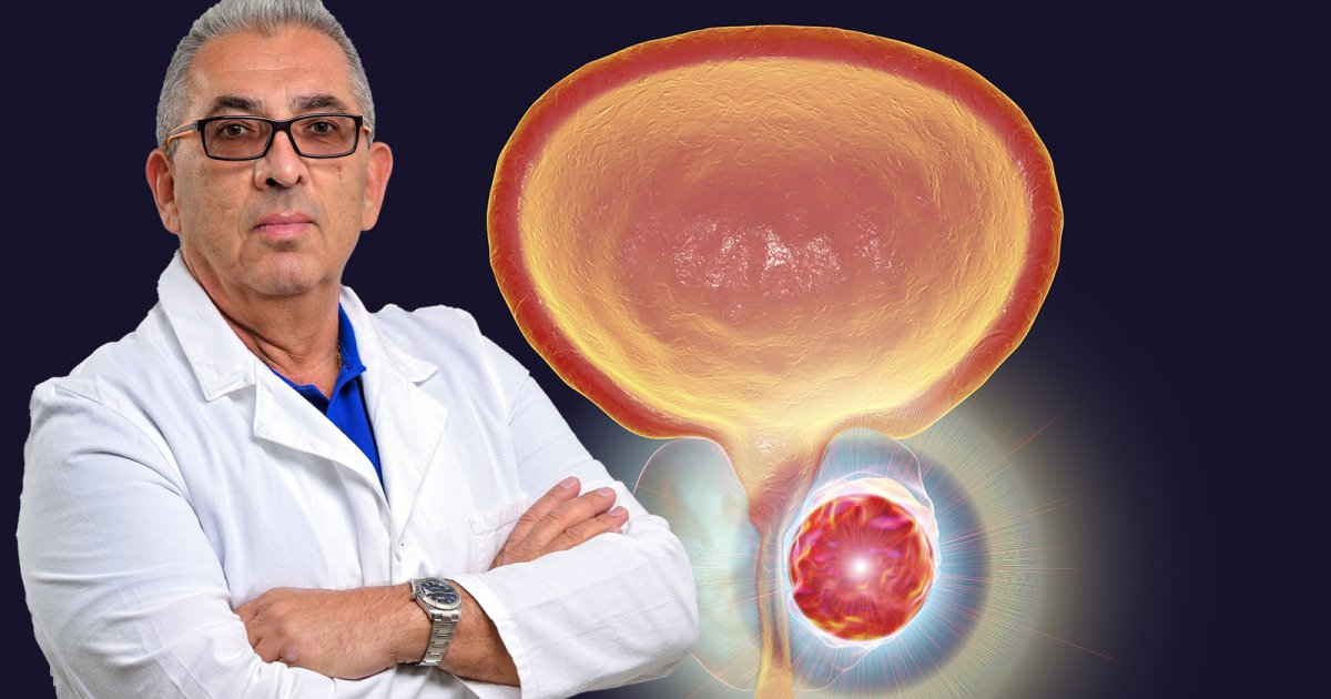 Rak prostate se leči dobrom dijagnostikom, hemijski kastratori čuvaju ...