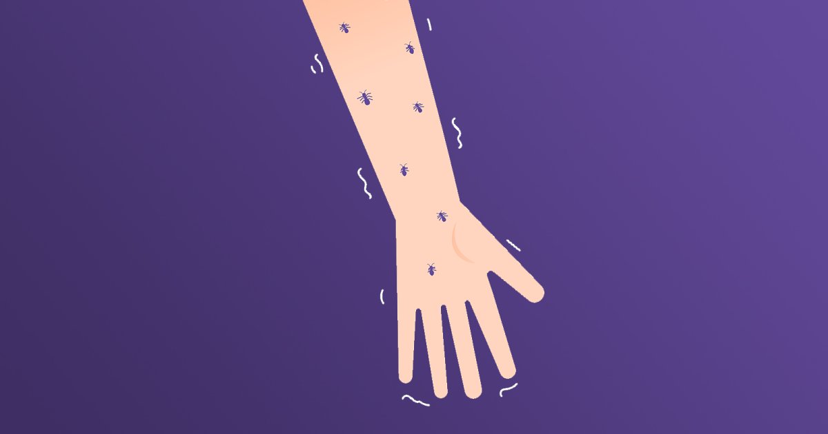 Zašto trne desna ruka i u kojim situacijama treba odmah reagovati ...