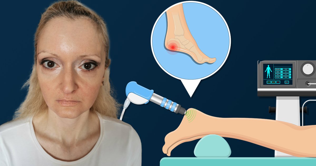 Petni trn – kako shock wave terapija uklanja bol i kalcifikate - eKlinika