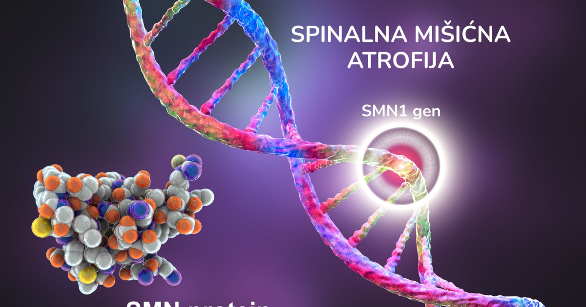 Spinalna mišićna atrofija može da se leči uz pomoć ova tri, u svetu ...