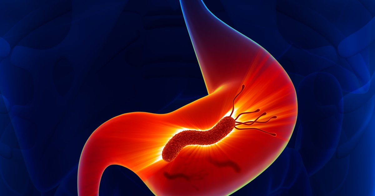 7 najčešćih simptoma infekcije heliko bakterijom - eKlinika