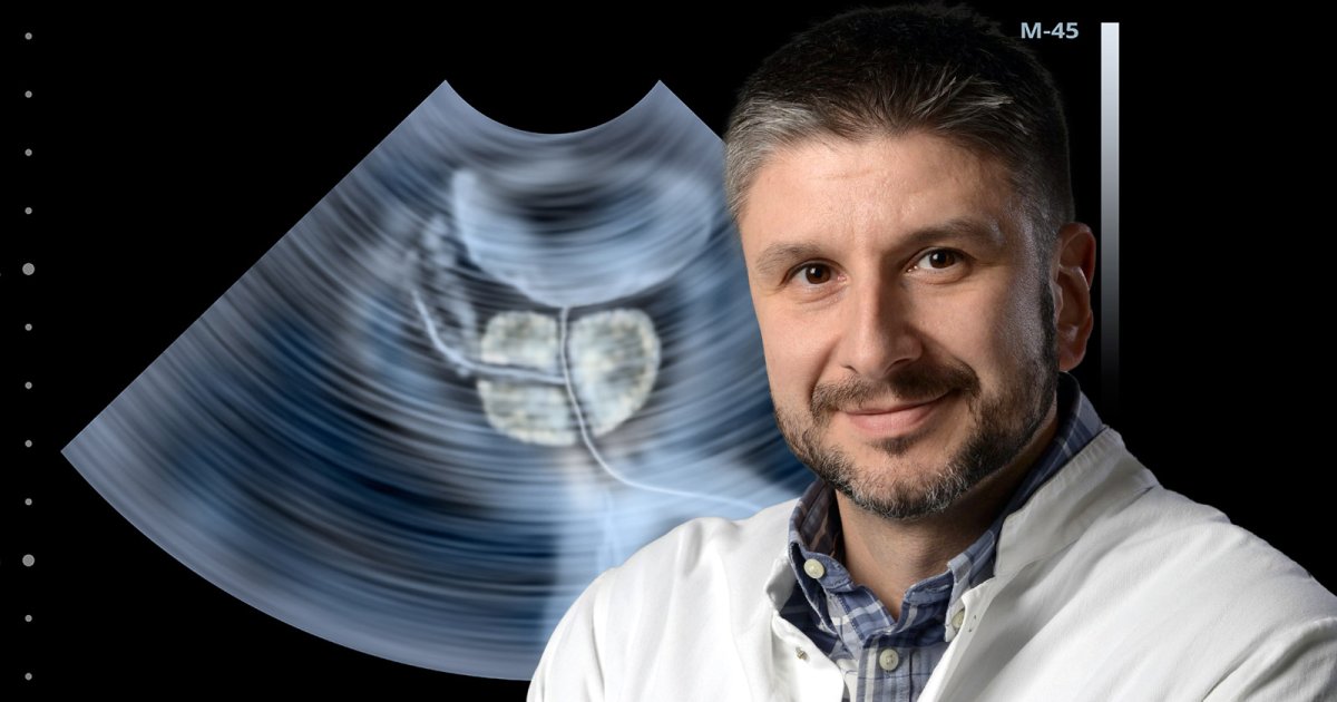 Biopsija prostate – kako izgleda, koliko tkiva se uzima, koje vrednosti ...