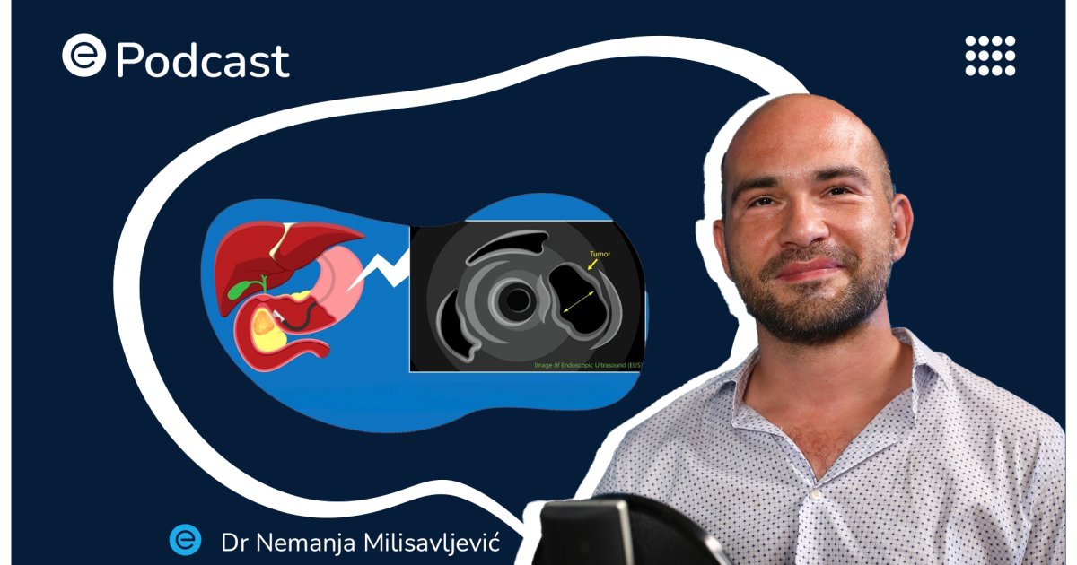 Šta sve može otkriti endoskopski ultrazvuk - eKlinika