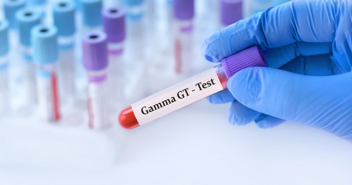 GGT enzim daje uvid u zdravlje jetre i žučnih kanala, koje su normalne ...