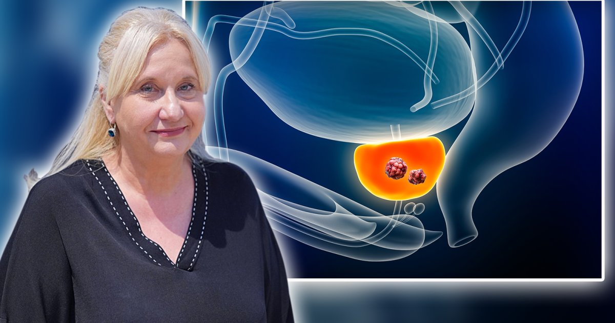 Koliko dugo mogu da žive pacijenti sa rakom prostate ako se bolest ...