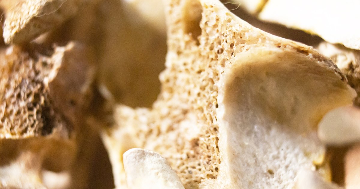 5 ključnih saveta za očuvanje gustine kostiju: Nešto je do vitamina ...