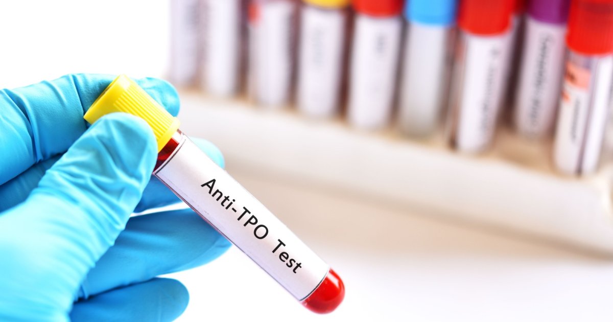 Šta kad test na antitela pokaže povišene vrednosti: Anti-TPO test ...