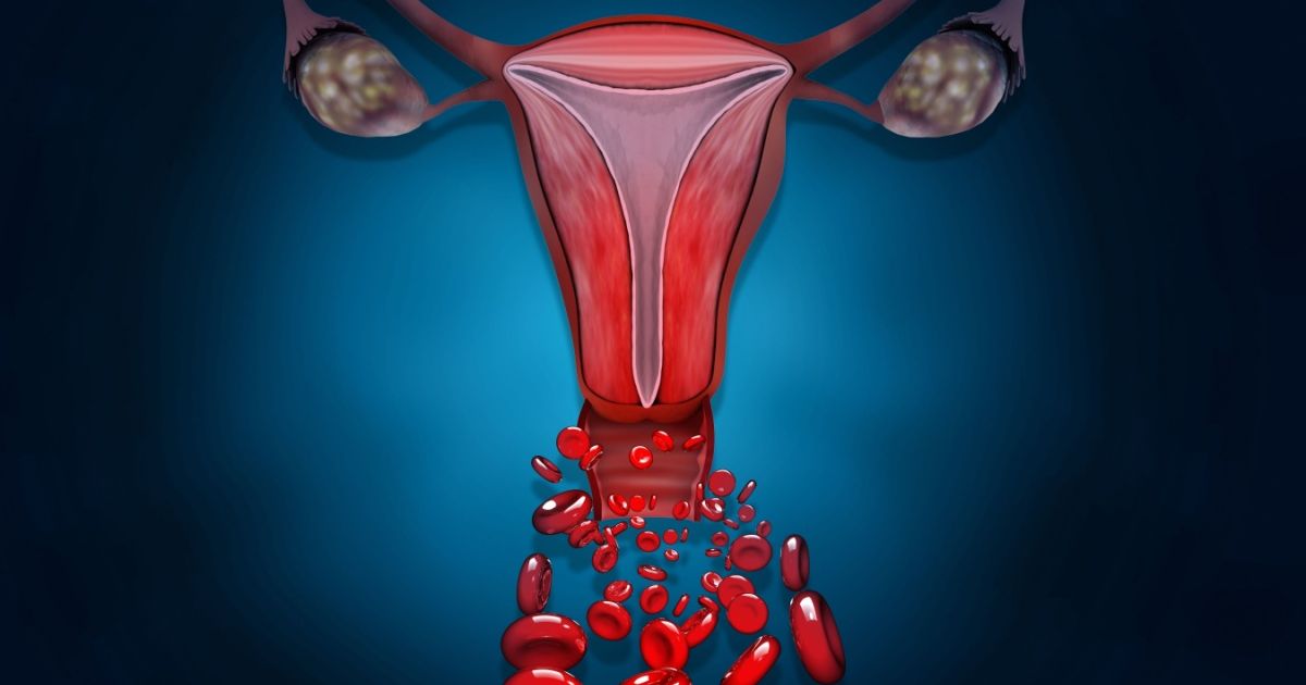 Testiranje menstrualne krvi na HPV virus moglo bi da postane ...